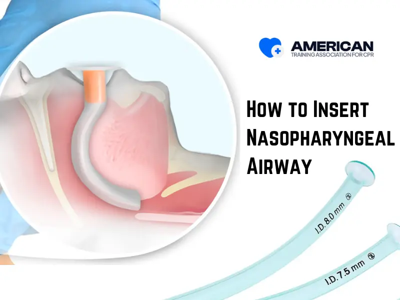 How to Insert Nasopharyngeal Airway: Guide for BLS Training